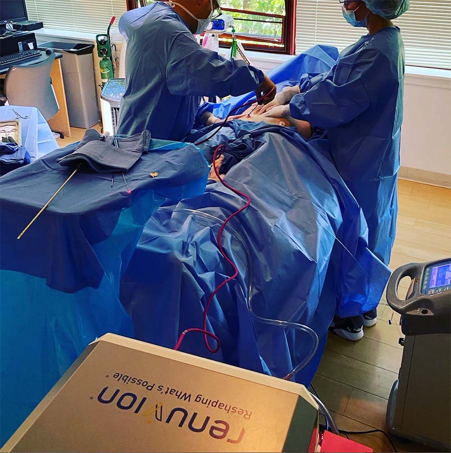 What Is J-Plasma? - The Lumen Center Philadelphia